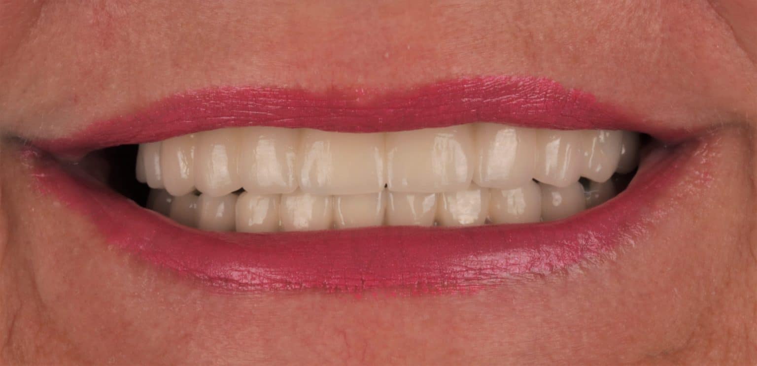 Cazuri clinice - Dental Elite